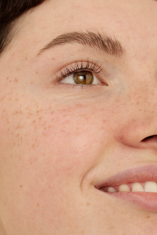 Couperose, rosacée : comment apaiser les rougeurs sur le visage