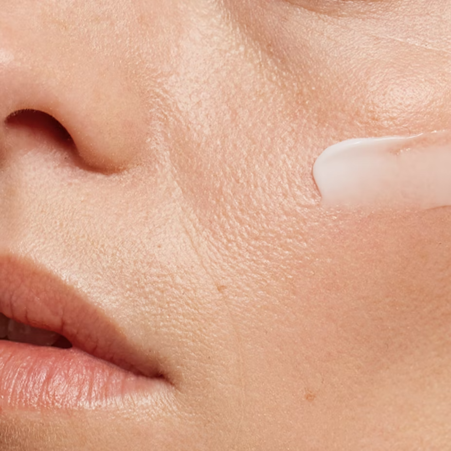 Couperose : symptômes et traitements pour apaiser la peau.